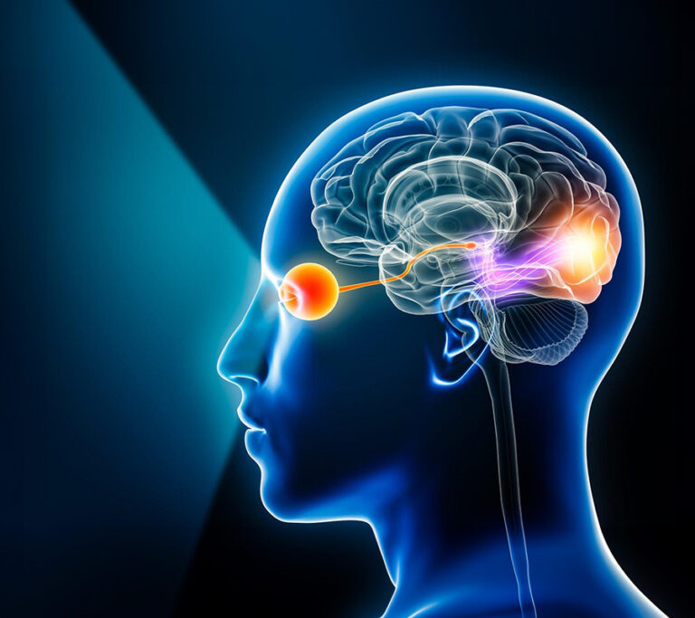 Irlen Syndrome – Irlen NZ